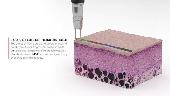 Pico – Skinpromedics